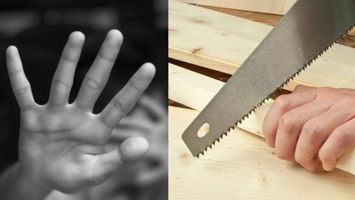 Tragis! Ayah Tega Gergaji Jari Tangan Anak Hingga Putus - suryapagi.com Tragis! Ayah Tega Gergaji Jari Tangan Anak Hingga Putus - suryapagi.com